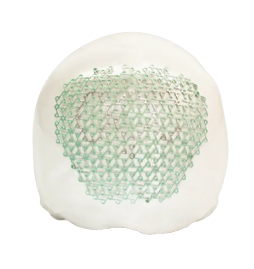 Craneoplastía - Soluciones en titanio para defectos craneales